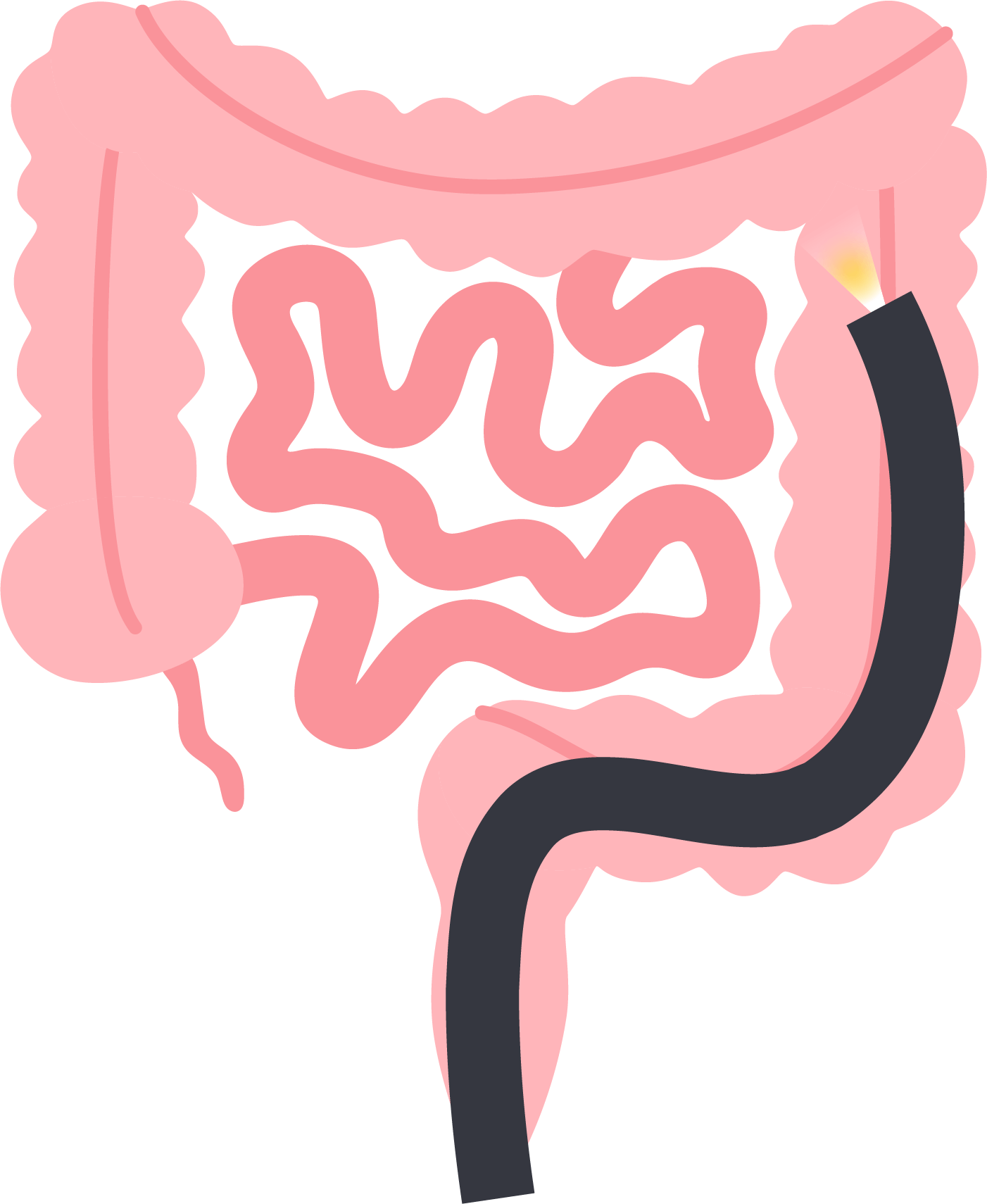 Colposcopy and Follow-Up of Abnormal Cervical Screen | Dr Kelly Hankins ...